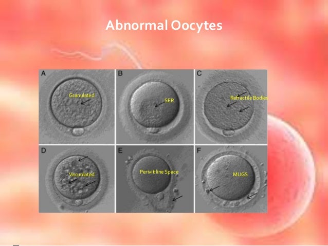 Oocyte