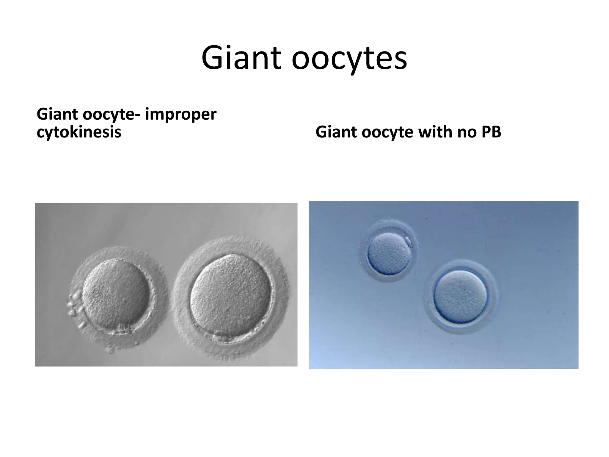 Oocyte and Embryo Grading blastocyst grading.pptx