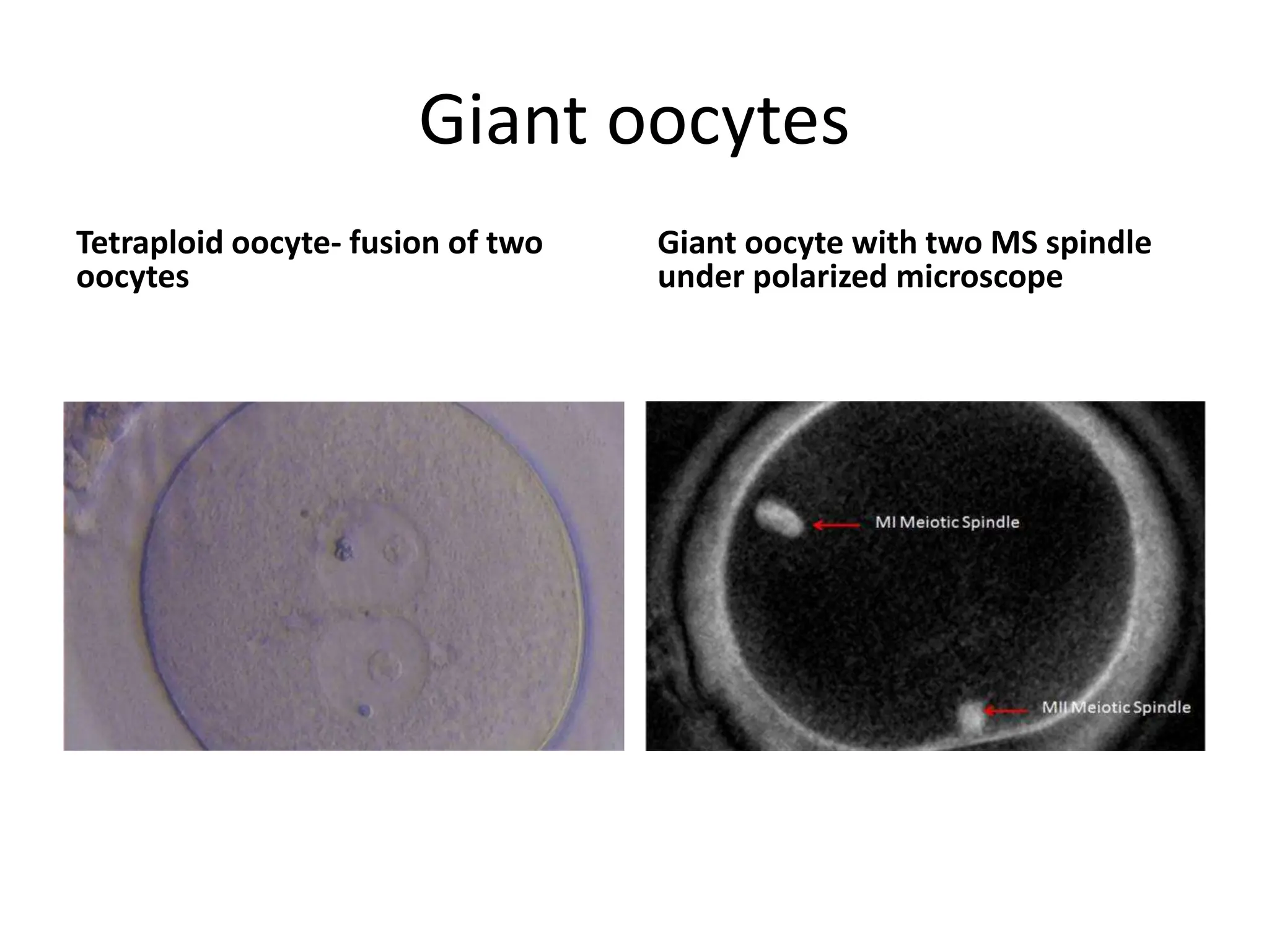 Oocyte and Embryo Grading blastocyst grading.pptx
