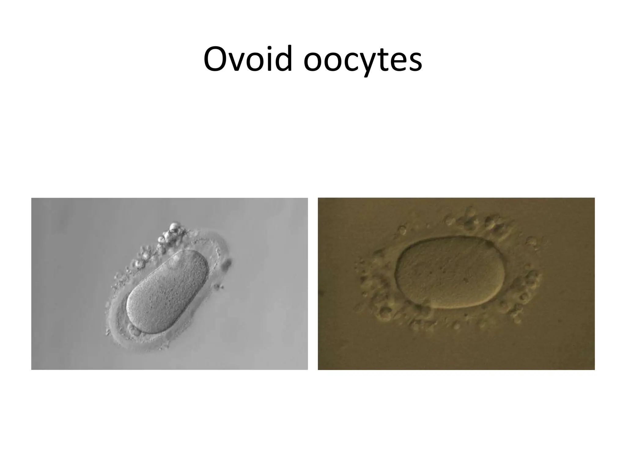 Oocyte and Embryo Grading blastocyst grading.pptx