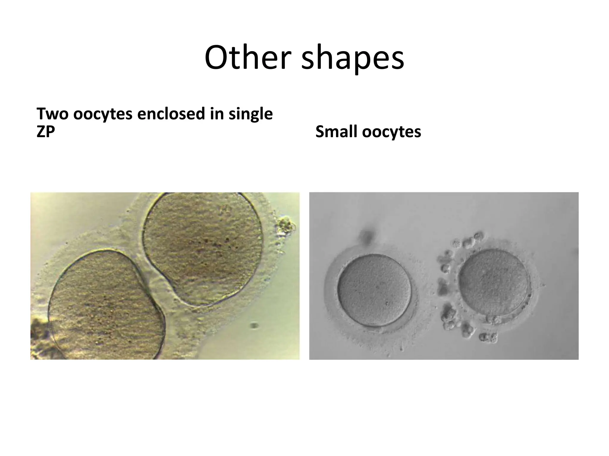 Oocyte and Embryo Grading blastocyst grading.pptx