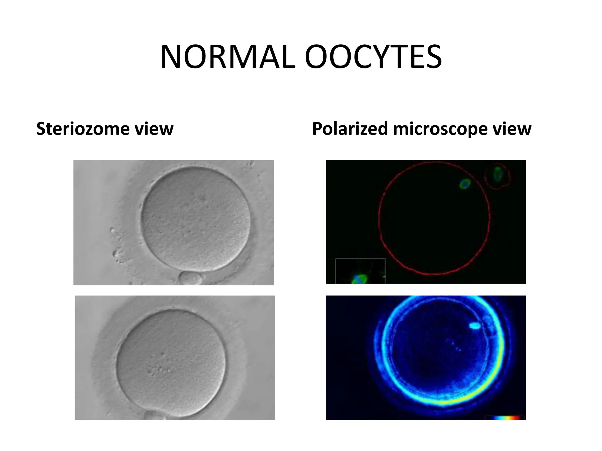 Oocyte and Embryo Grading blastocyst grading.pptx
