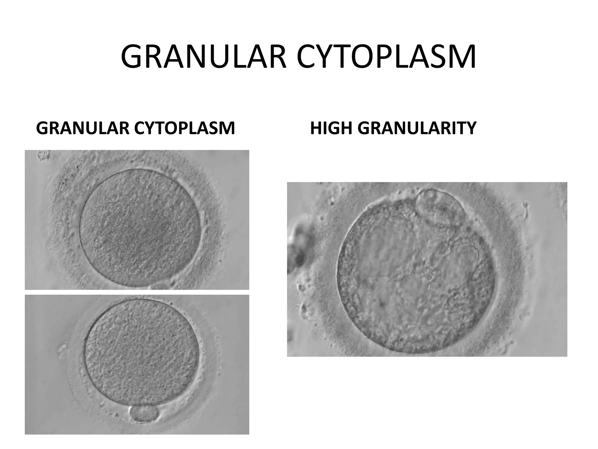 Oocyte and Embryo Grading blastocyst grading.pptx