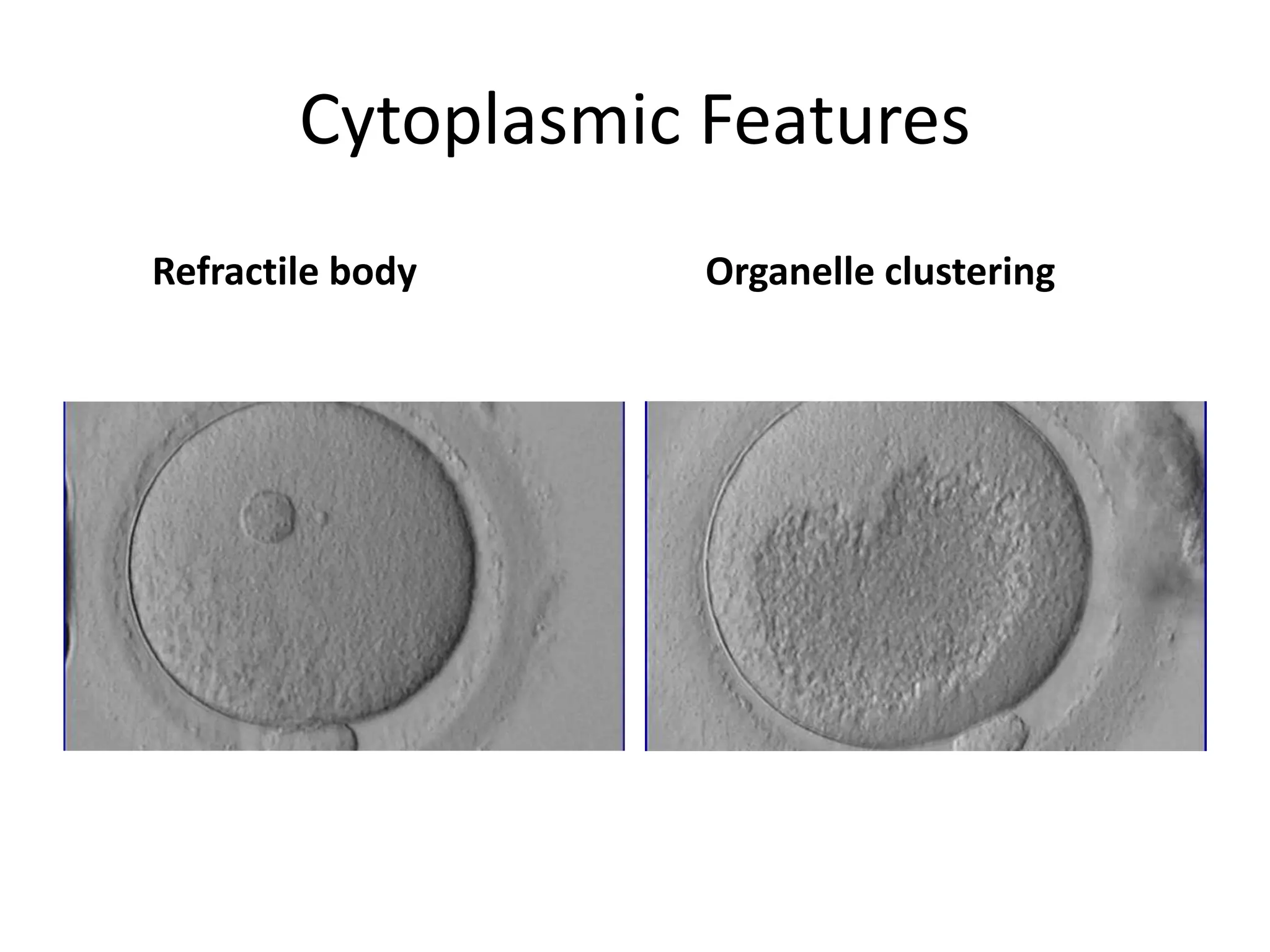 Oocyte and Embryo Grading blastocyst grading.pptx