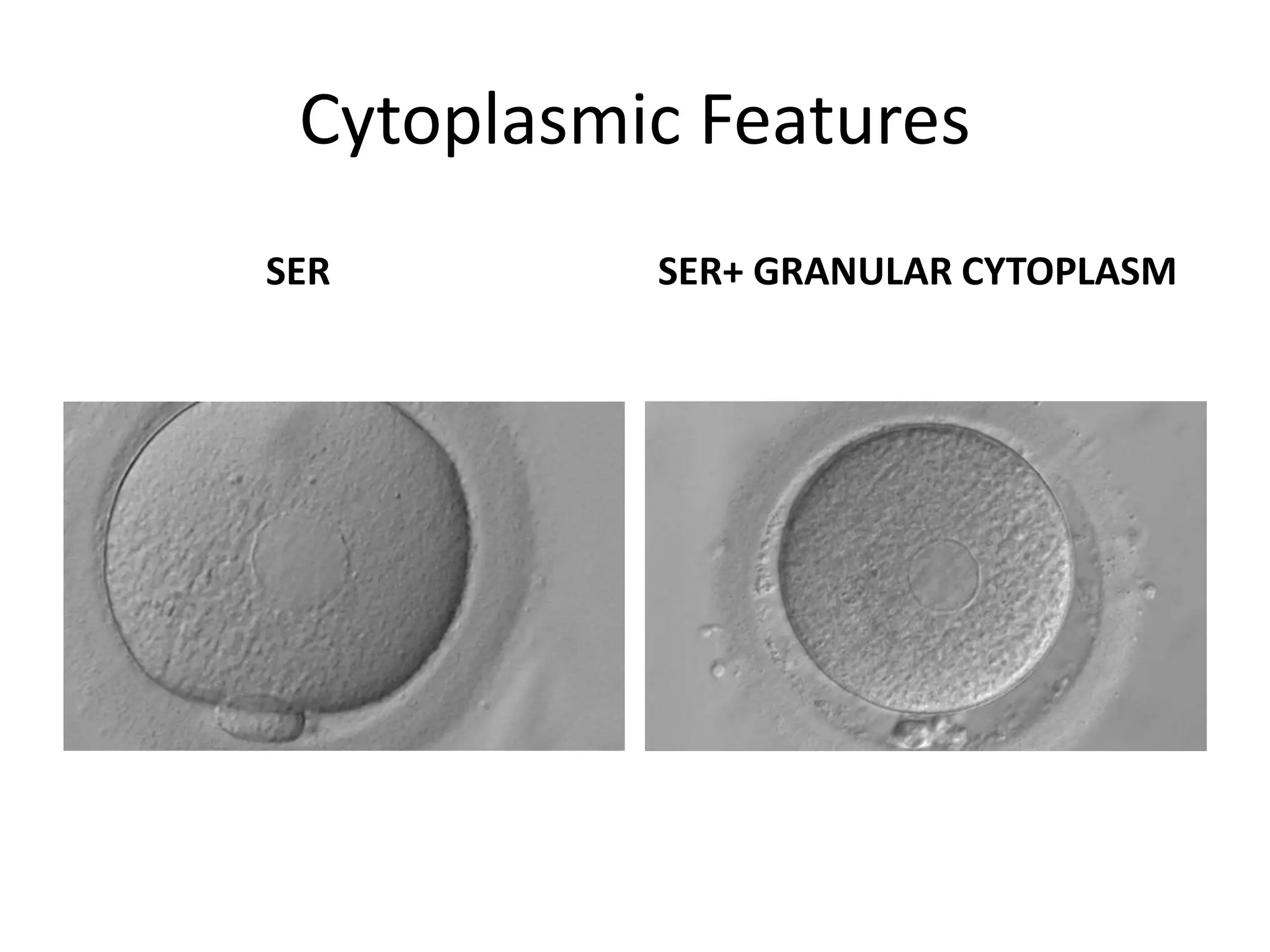 Oocyte and Embryo Grading blastocyst grading.pptx