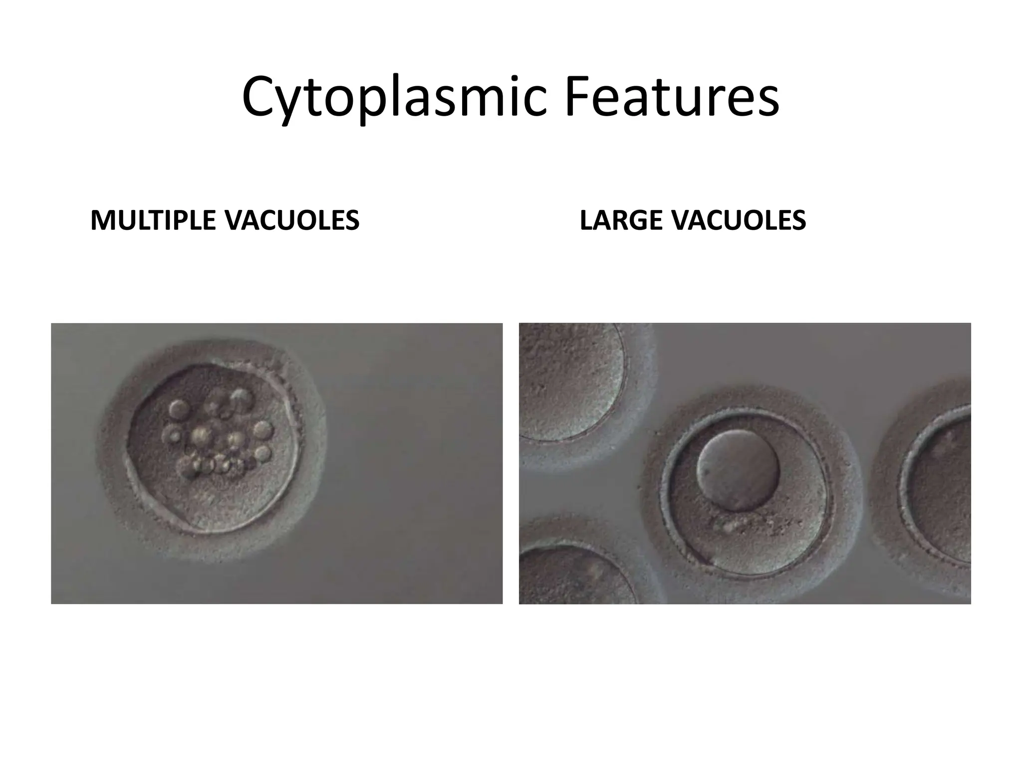Oocyte and Embryo Grading blastocyst grading.pptx