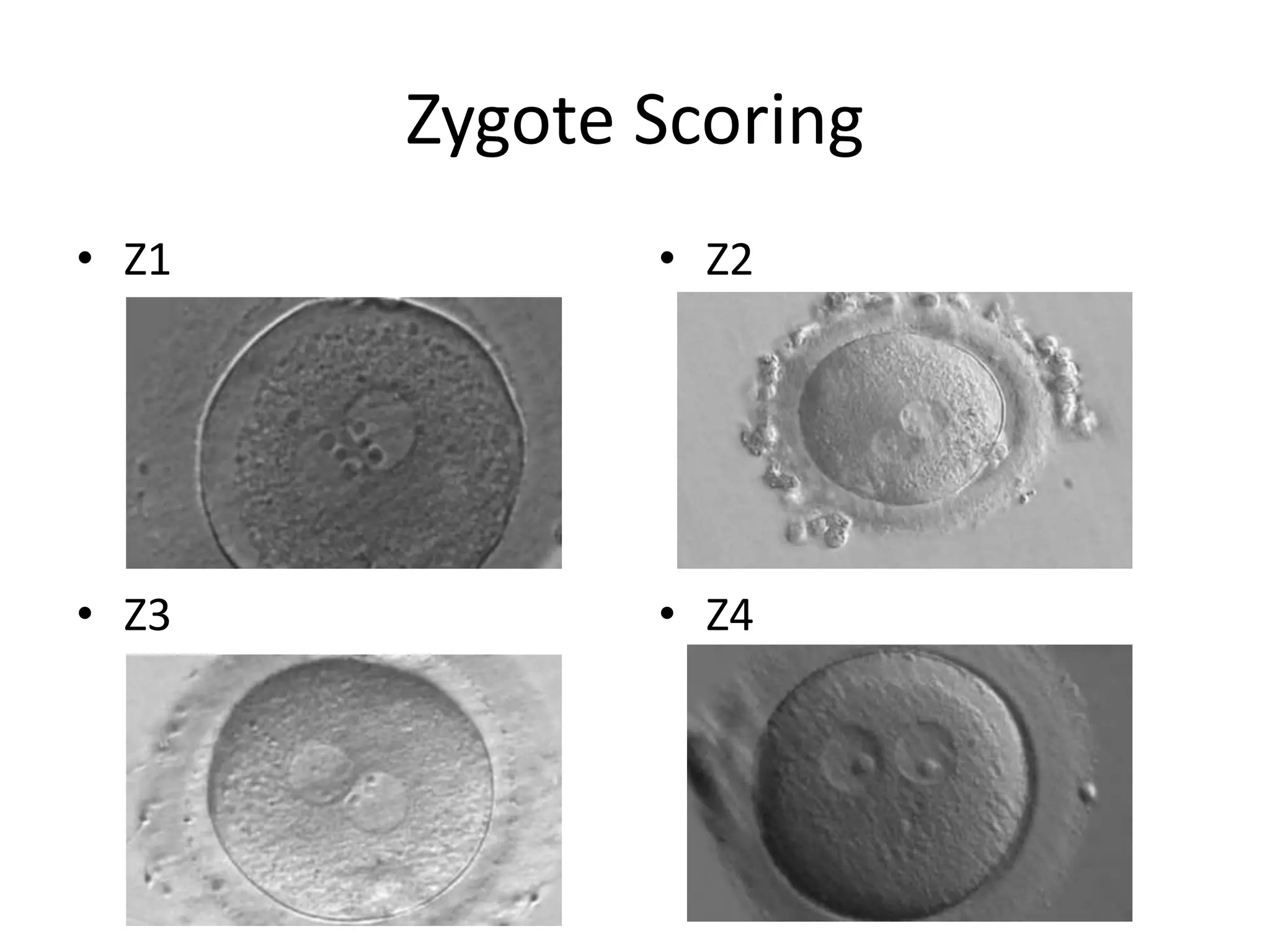 Oocyte and Embryo Grading blastocyst grading.pptx