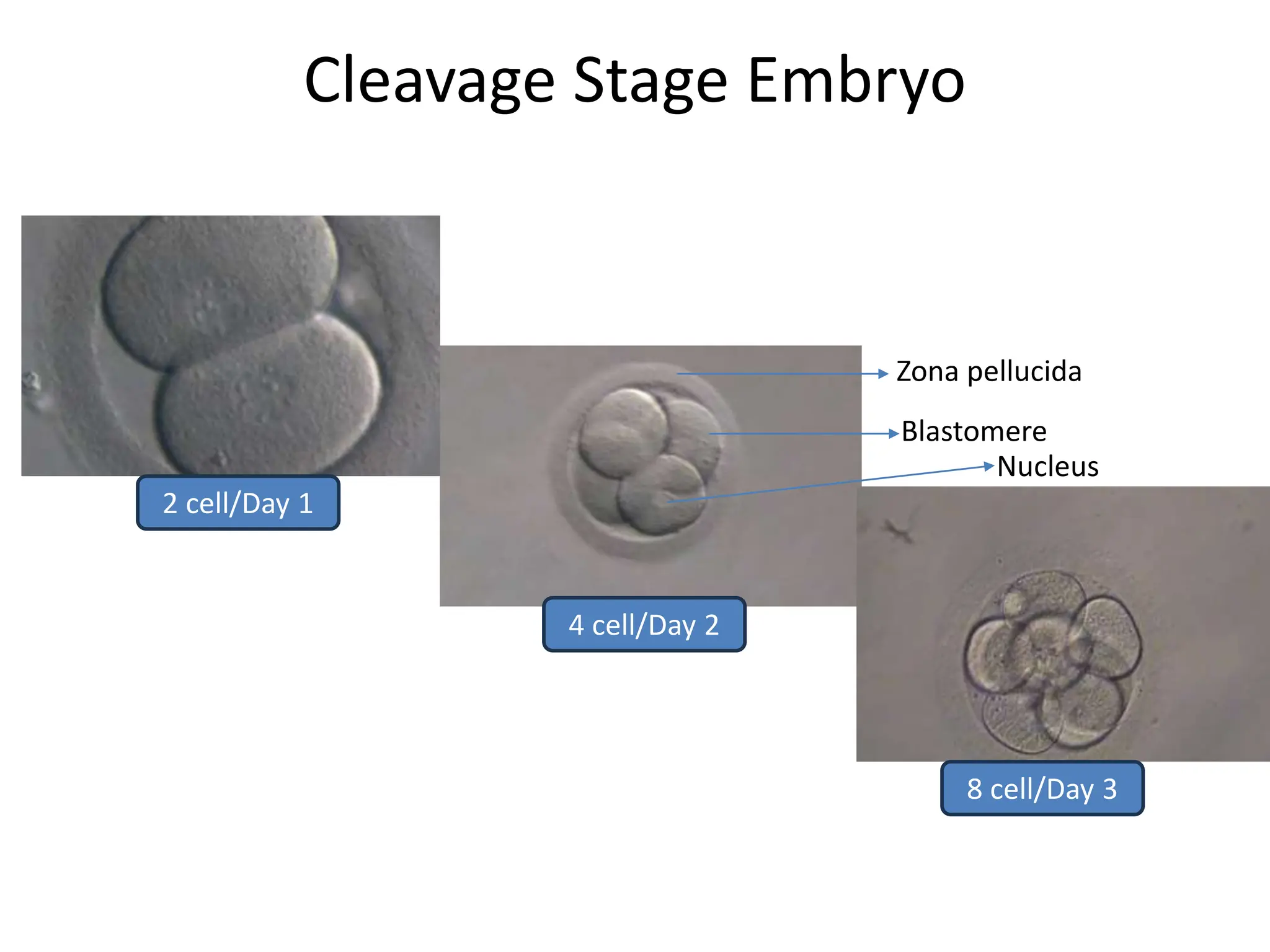 Oocyte and Embryo Grading blastocyst grading.pptx