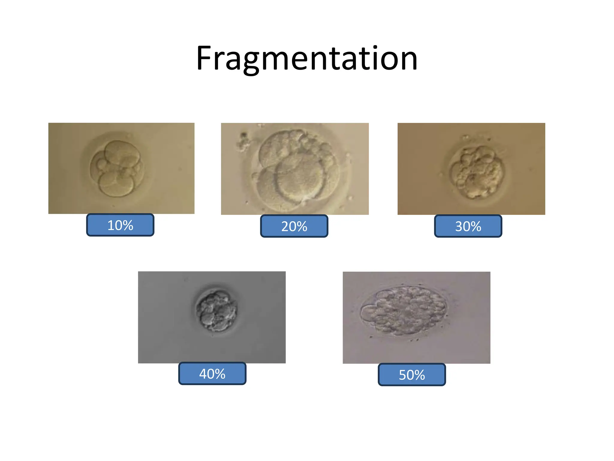 Oocyte and Embryo Grading blastocyst grading.pptx