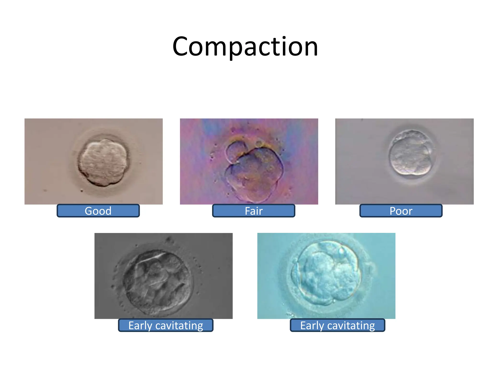Oocyte and Embryo Grading blastocyst grading.pptx