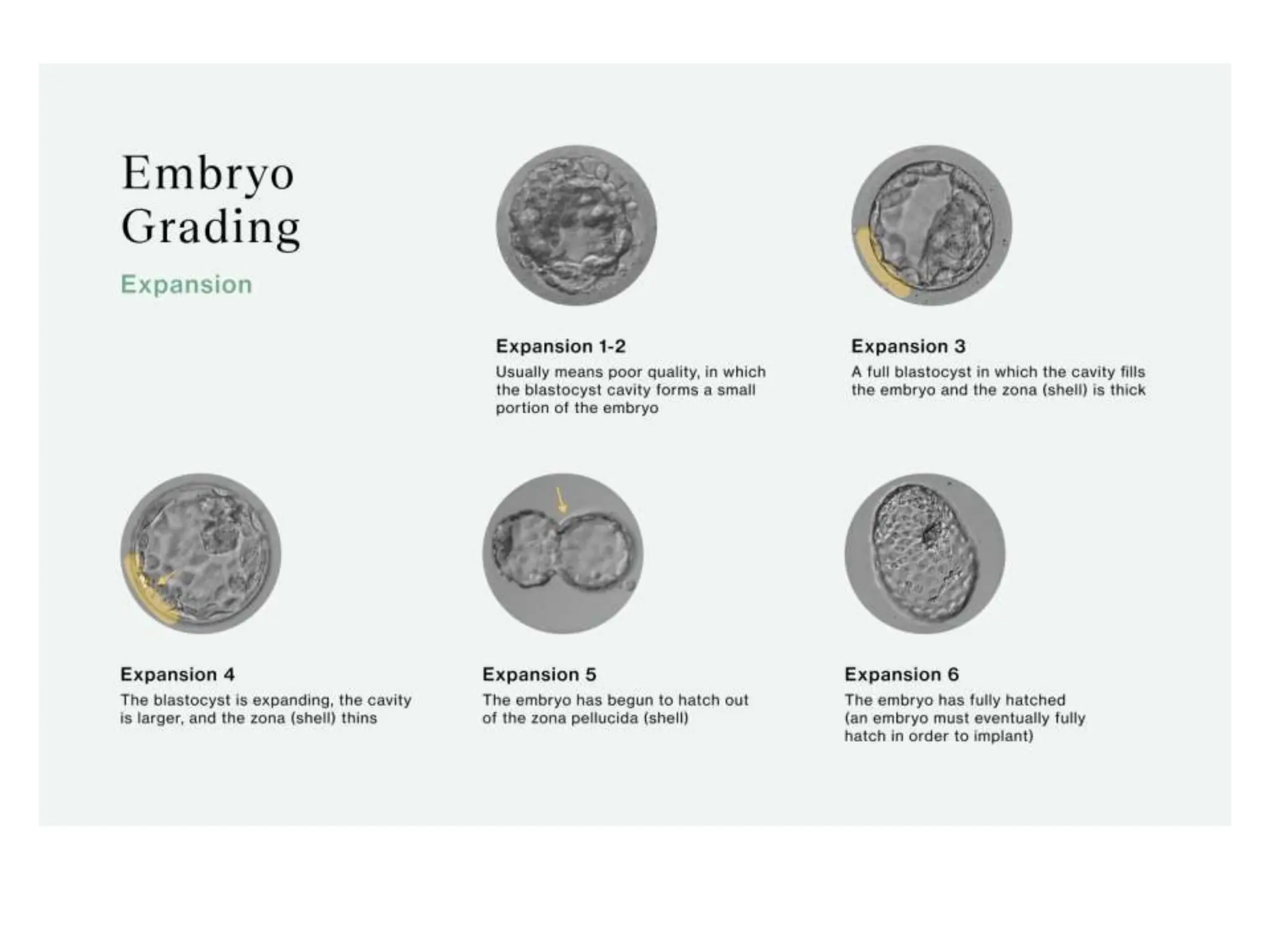 Oocyte and Embryo Grading blastocyst grading.pptx