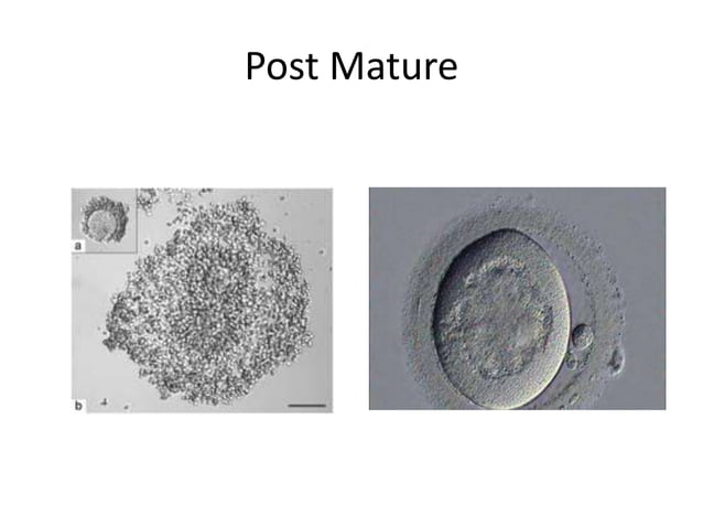 Oocyte and Embryo Grading blastocyst grading.pptx