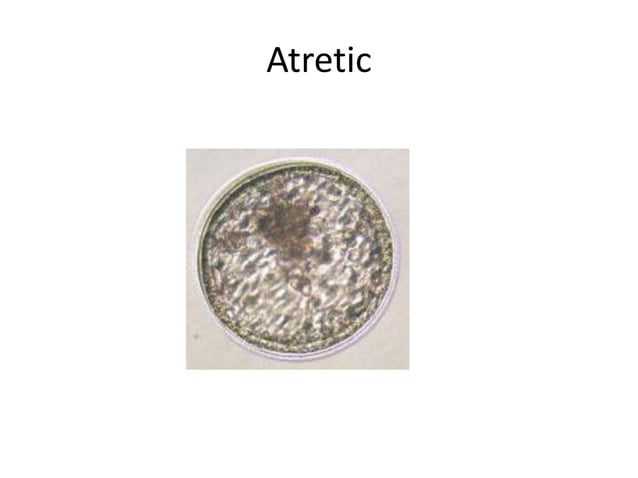 Oocyte and Embryo Grading blastocyst grading.pptx