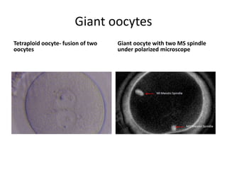 Oocyte and Embryo Grading blastocyst grading.pptx