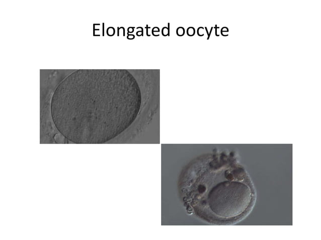 Oocyte and Embryo Grading blastocyst grading.pptx