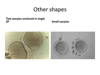 Oocyte and Embryo Grading blastocyst grading.pptx