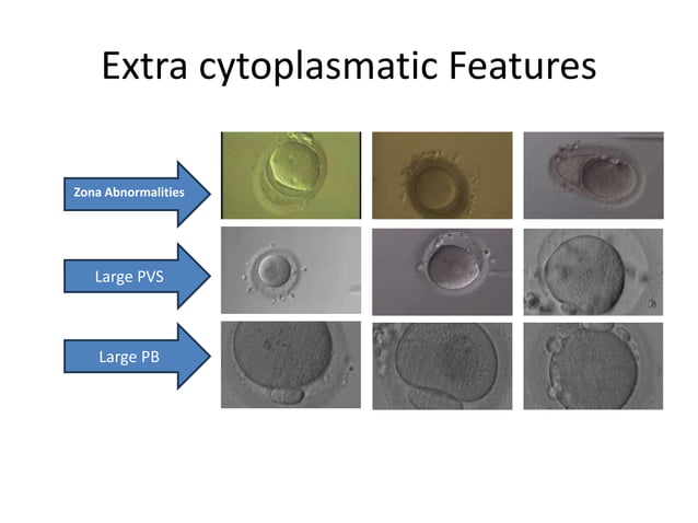 Oocyte and Embryo Grading blastocyst grading.pptx