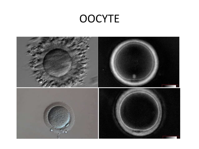 Oocyte and Embryo Grading blastocyst grading.pptx