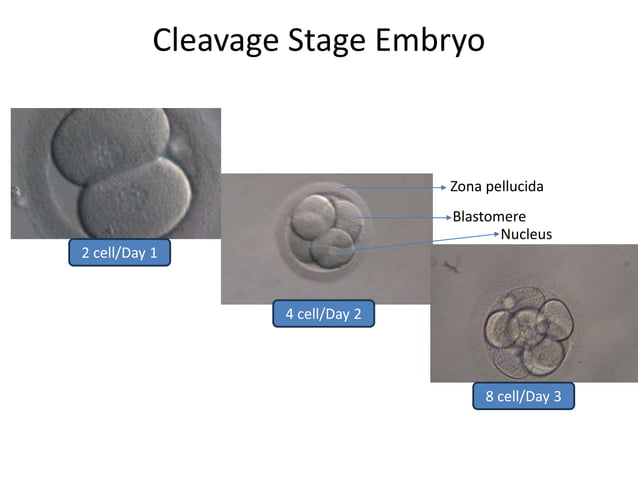 Oocyte and Embryo Grading blastocyst grading.pptx