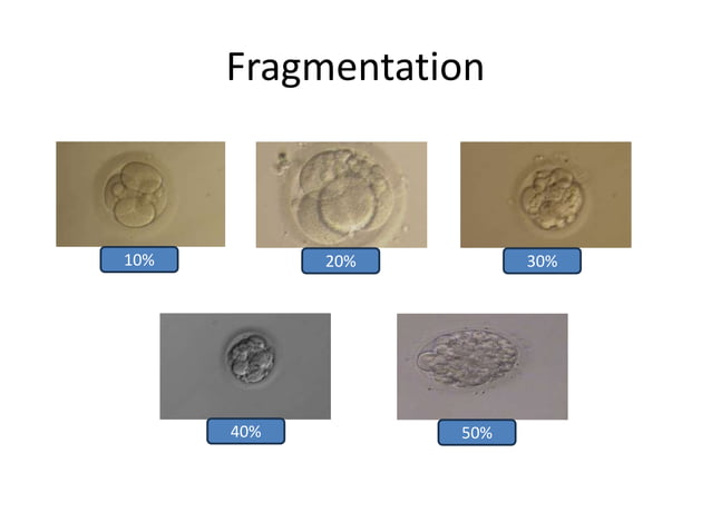 Oocyte and Embryo Grading blastocyst grading.pptx