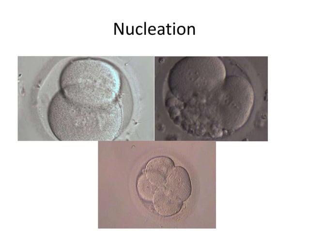 Oocyte and Embryo Grading blastocyst grading.pptx