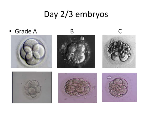 Oocyte and Embryo Grading blastocyst grading.pptx