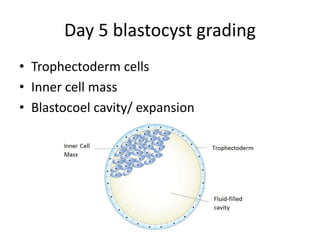 Oocyte and Embryo Grading blastocyst grading.pptx