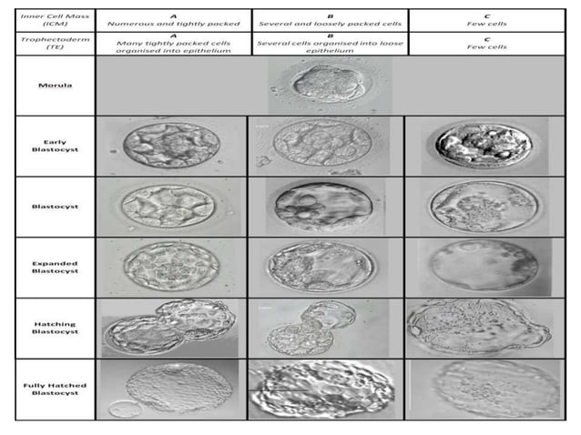 Oocyte and Embryo Grading blastocyst grading.pptx