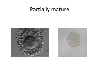 Oocyte and Embryo Grading blastocyst grading.pptx