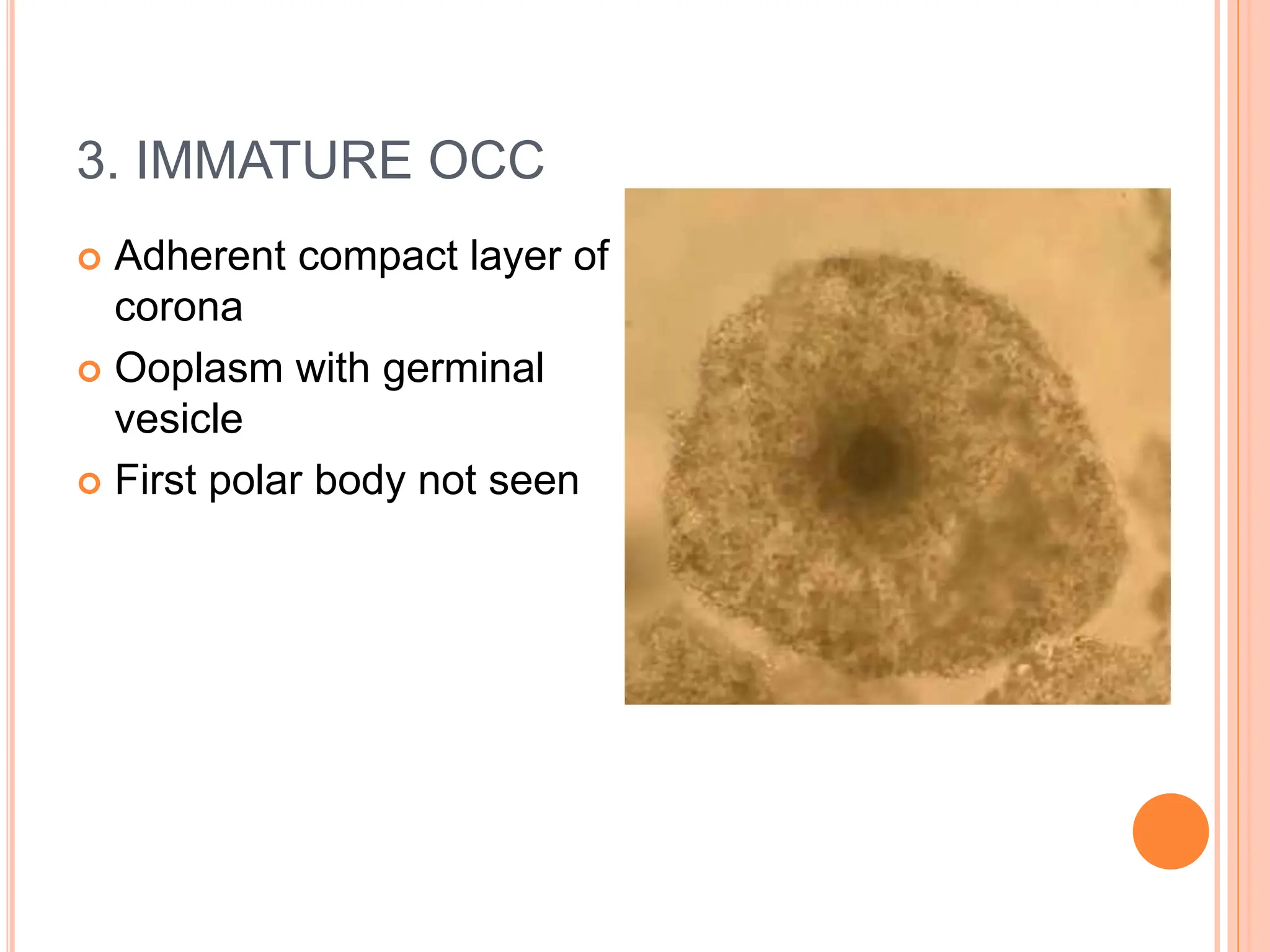 Oocyte grading.pptx... dhsvsusvshshhshsh | PPTX