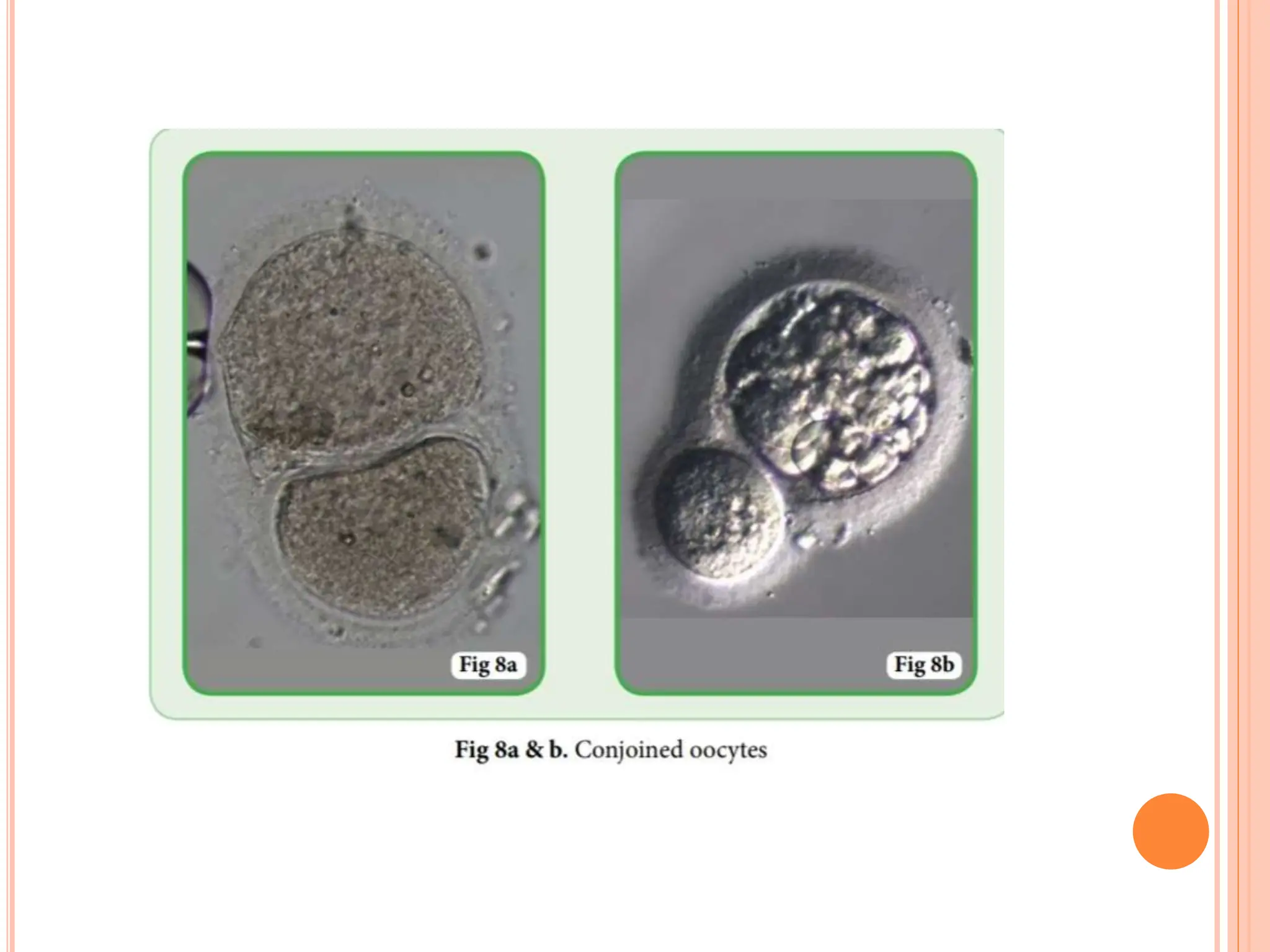 Oocyte grading.pptx... dhsvsusvshshhshsh | PPTX