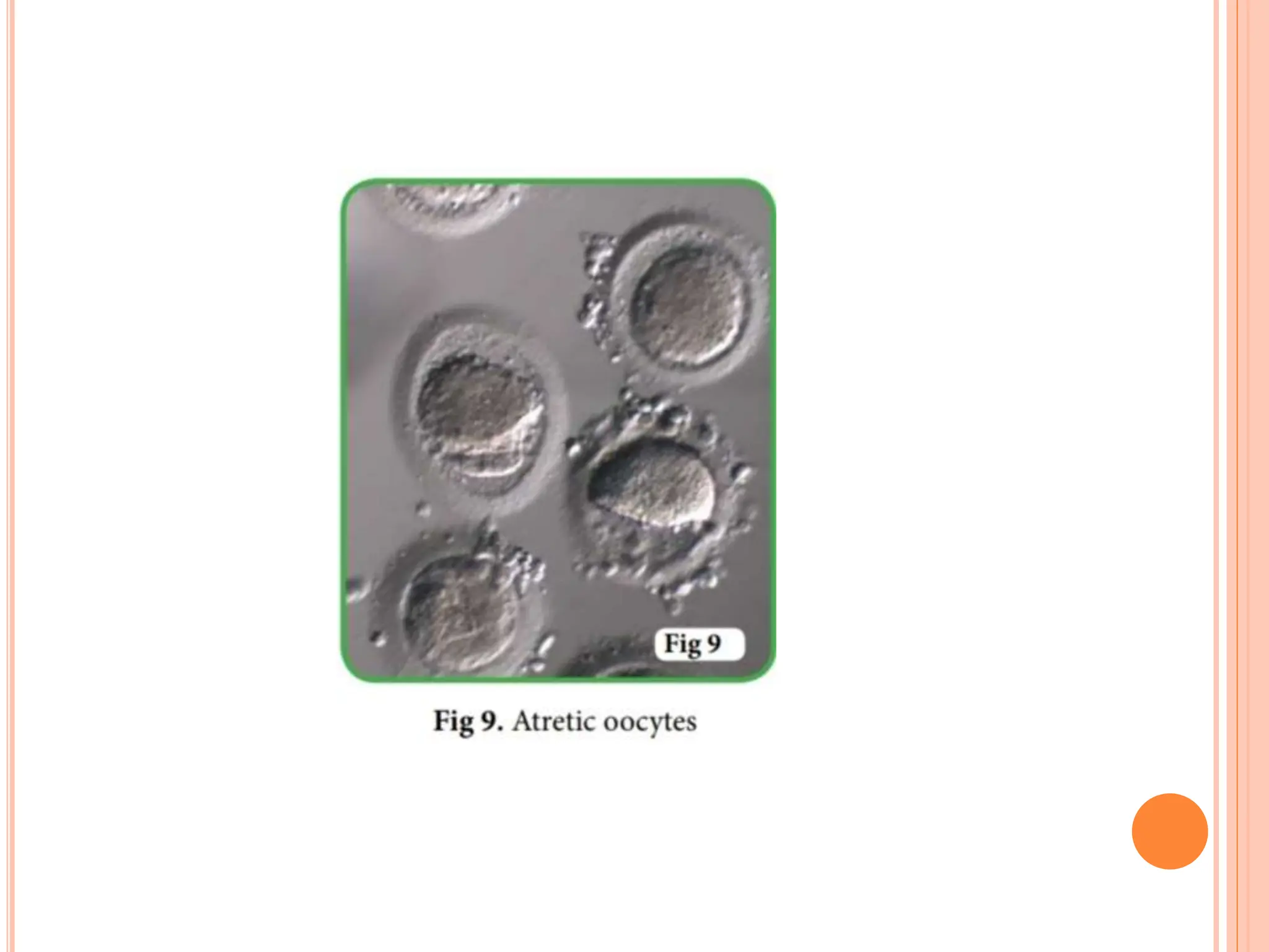 Oocyte grading.pptx... dhsvsusvshshhshsh | PPTX