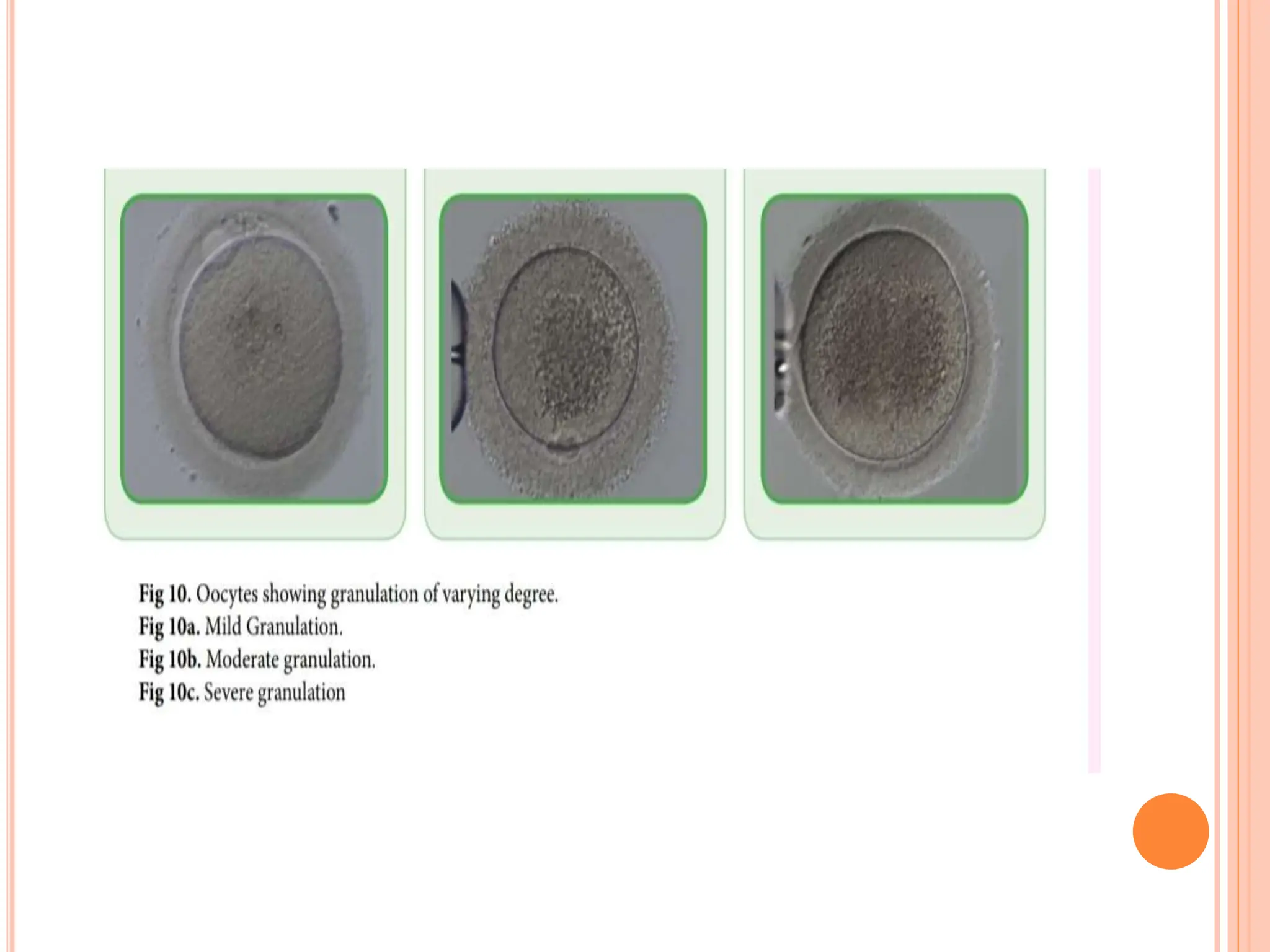 Oocyte grading.pptx... dhsvsusvshshhshsh | PPTX