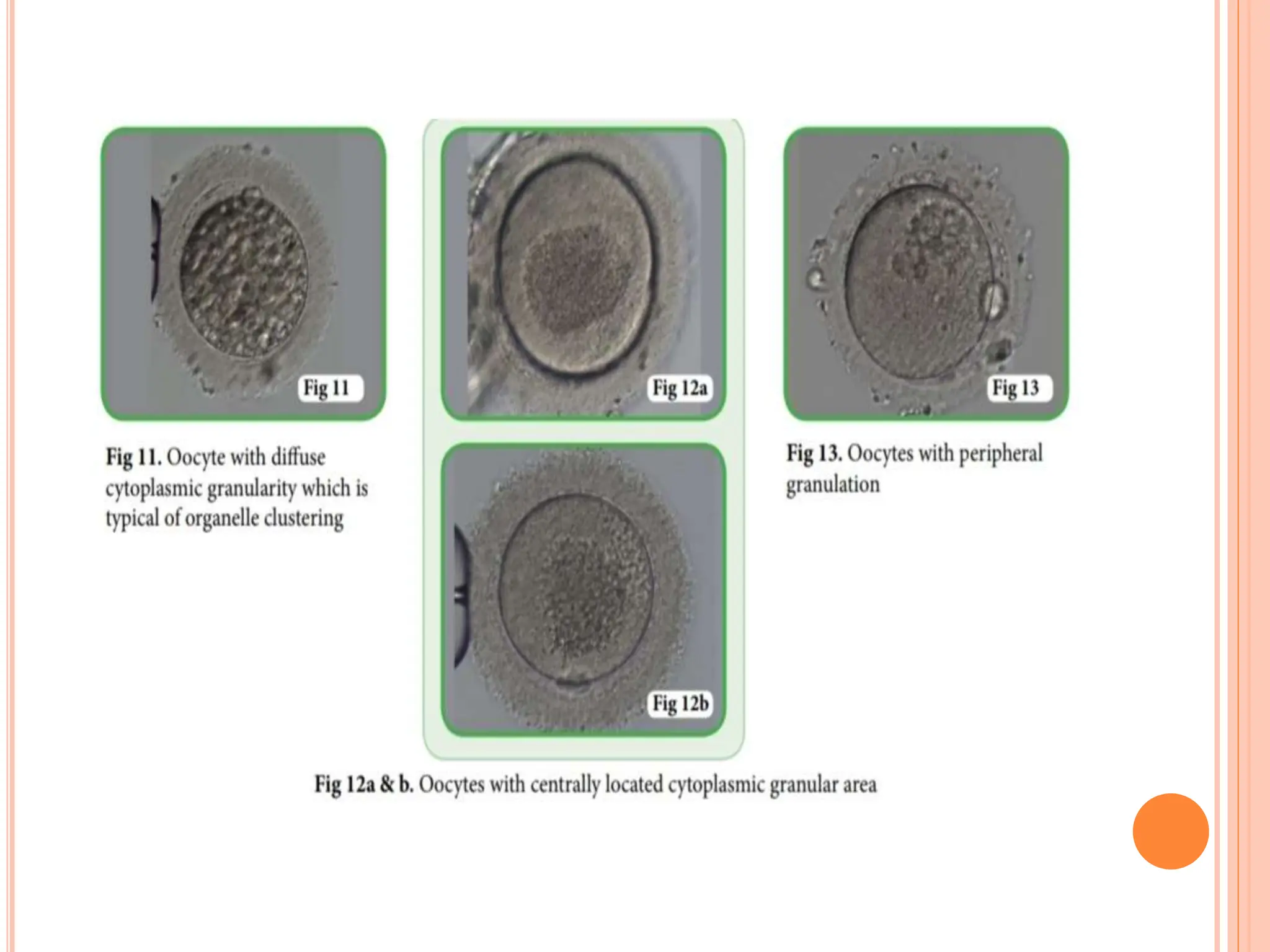 Oocyte grading.pptx... dhsvsusvshshhshsh | PPTX