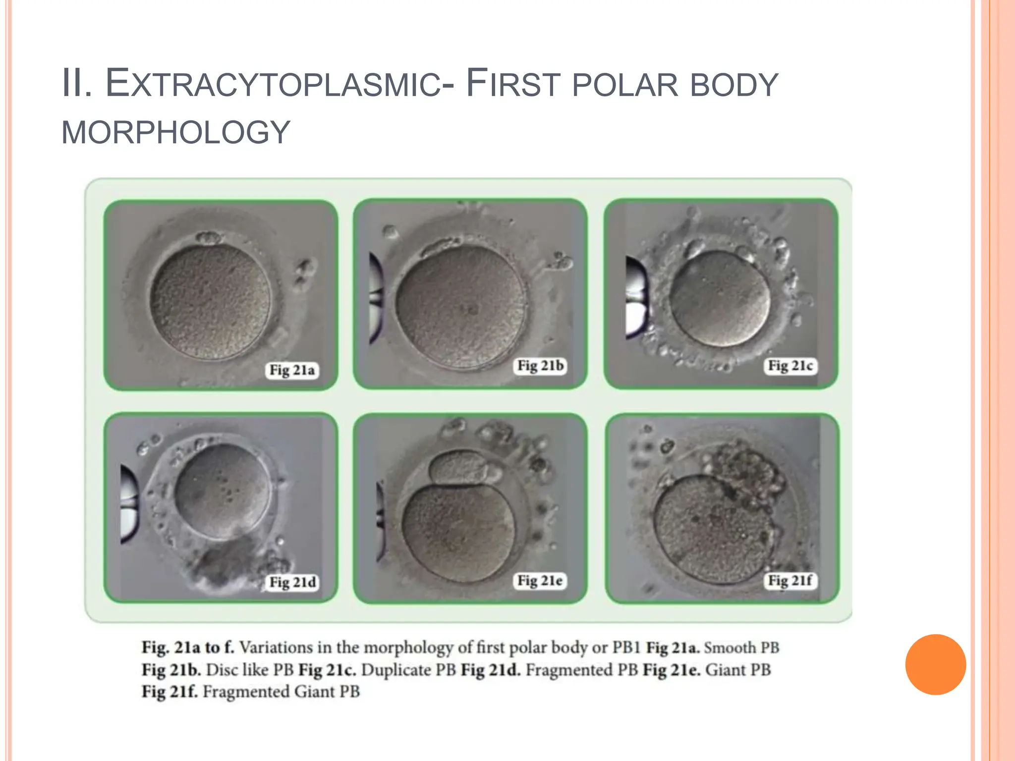 Oocyte grading.pptx... dhsvsusvshshhshsh | PPTX
