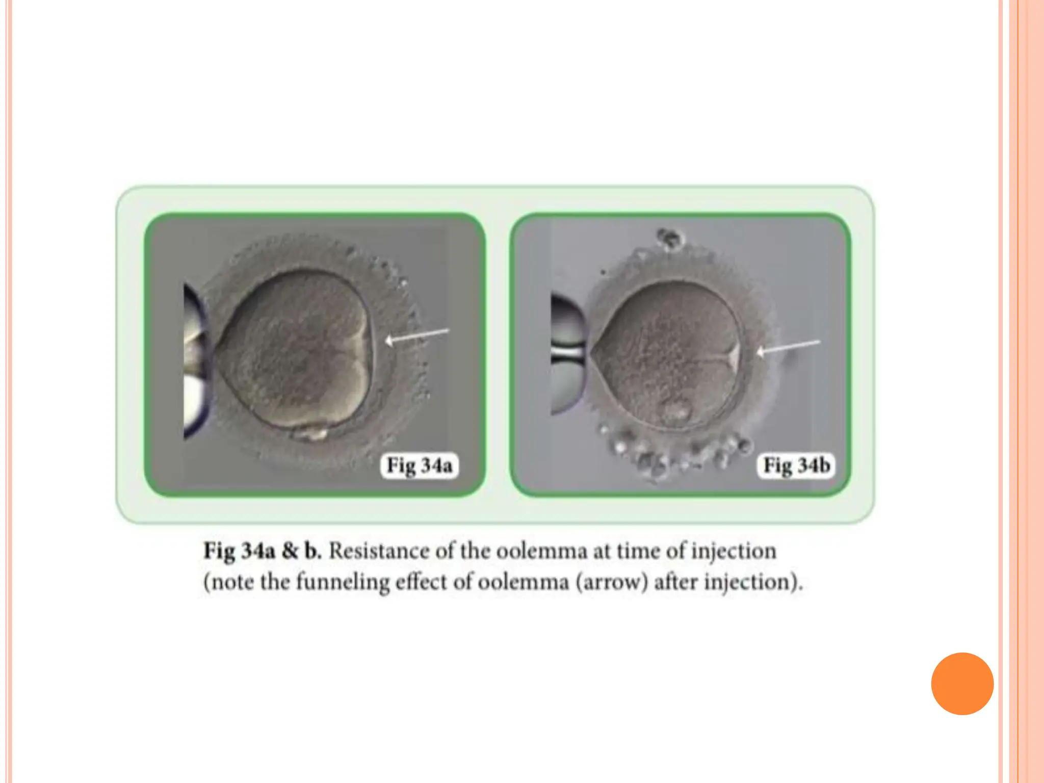 Oocyte grading.pptx... dhsvsusvshshhshsh | PPTX