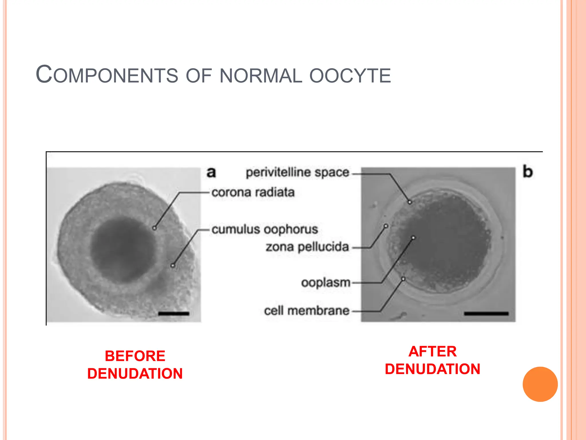 Oocyte grading.pptx... dhsvsusvshshhshsh | PPTX