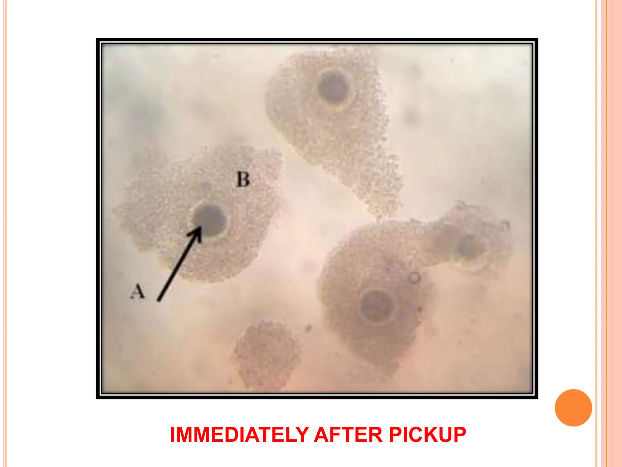Oocyte grading.pptx... dhsvsusvshshhshsh | PPTX