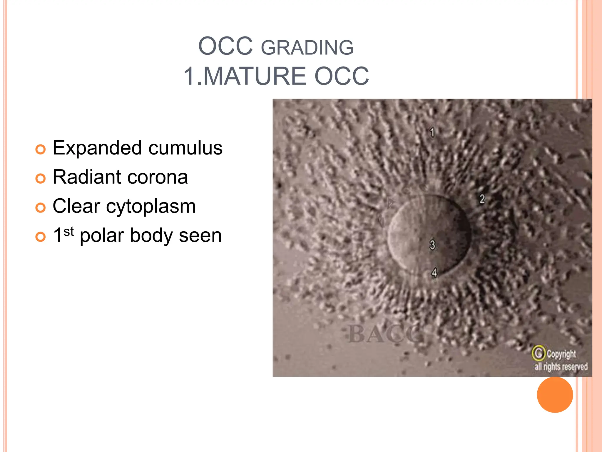Oocyte grading.pptx... dhsvsusvshshhshsh | PPTX
