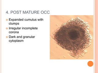 Oocyte grading.pptx... dhsvsusvshshhshsh | PPTX