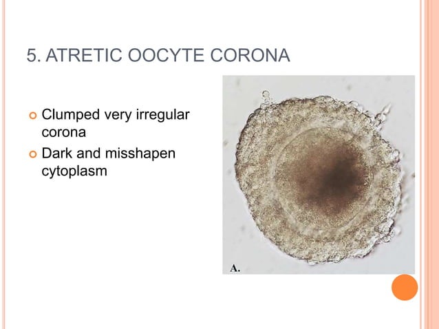 Oocyte grading.pptx... dhsvsusvshshhshsh | PPTX