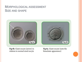 Oocyte grading.pptx... dhsvsusvshshhshsh | PPTX