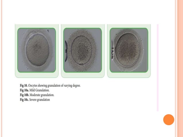 Oocyte grading.pptx... dhsvsusvshshhshsh | PPTX