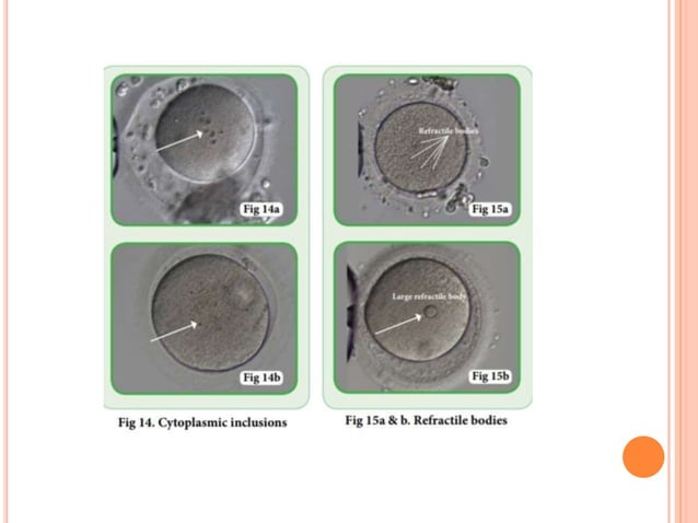 Oocyte grading.pptx... dhsvsusvshshhshsh | PPTX