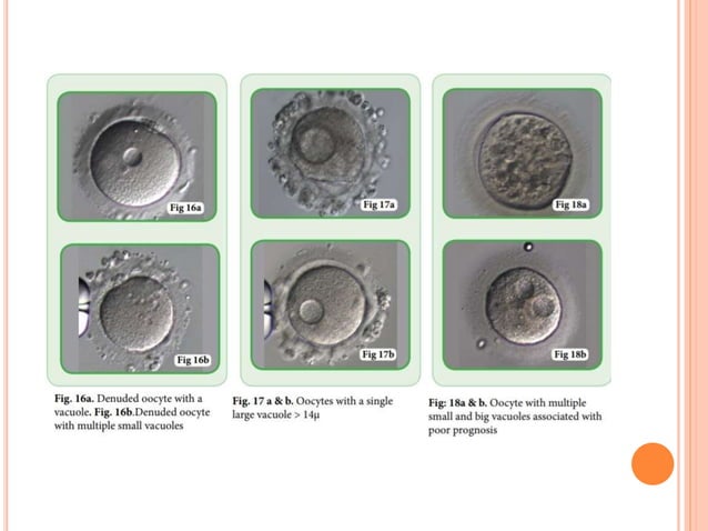 Oocyte grading.pptx... dhsvsusvshshhshsh | PPTX