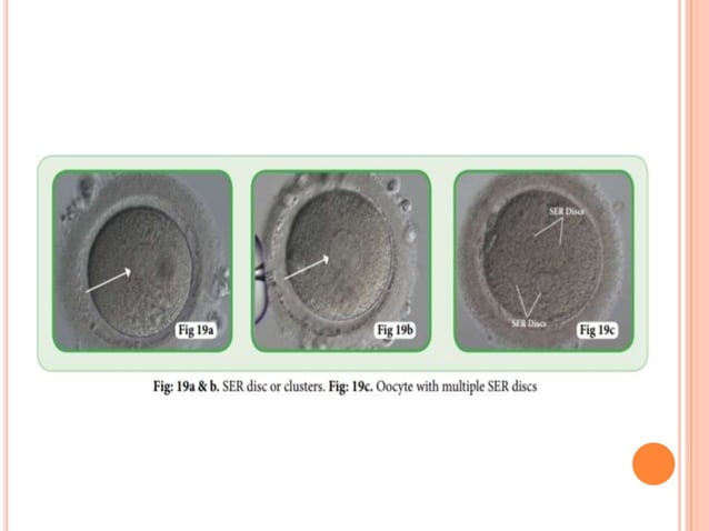 Oocyte grading.pptx... dhsvsusvshshhshsh | PPTX