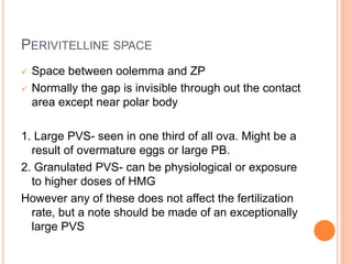 Oocyte grading.pptx... dhsvsusvshshhshsh | PPTX