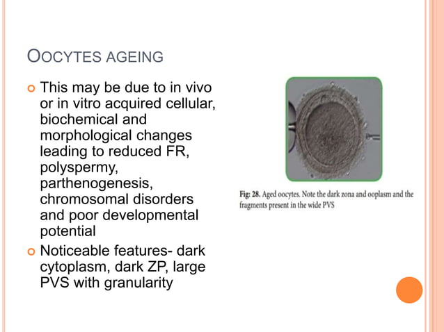 Oocyte grading.pptx... dhsvsusvshshhshsh | PPTX