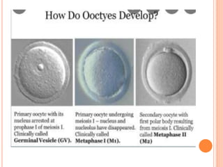 Oocyte grading.pptx... dhsvsusvshshhshsh | PPTX