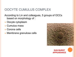 Oocyte grading.pptx... dhsvsusvshshhshsh | PPTX
